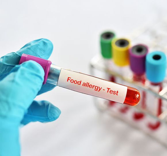 Allergy Testing Through Allergy First | Grampians Consulting Suites