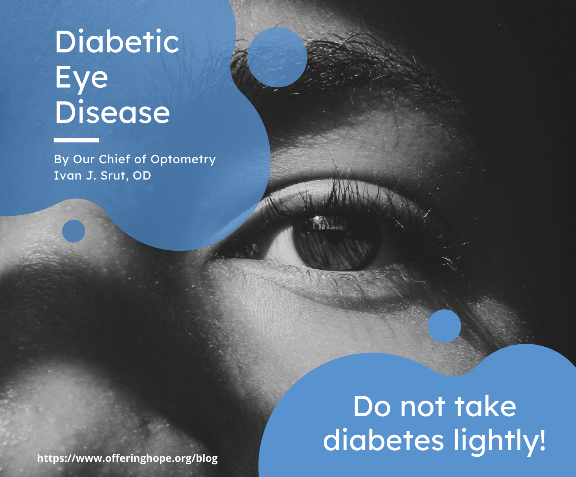 Diabetic Eye Disease 2021