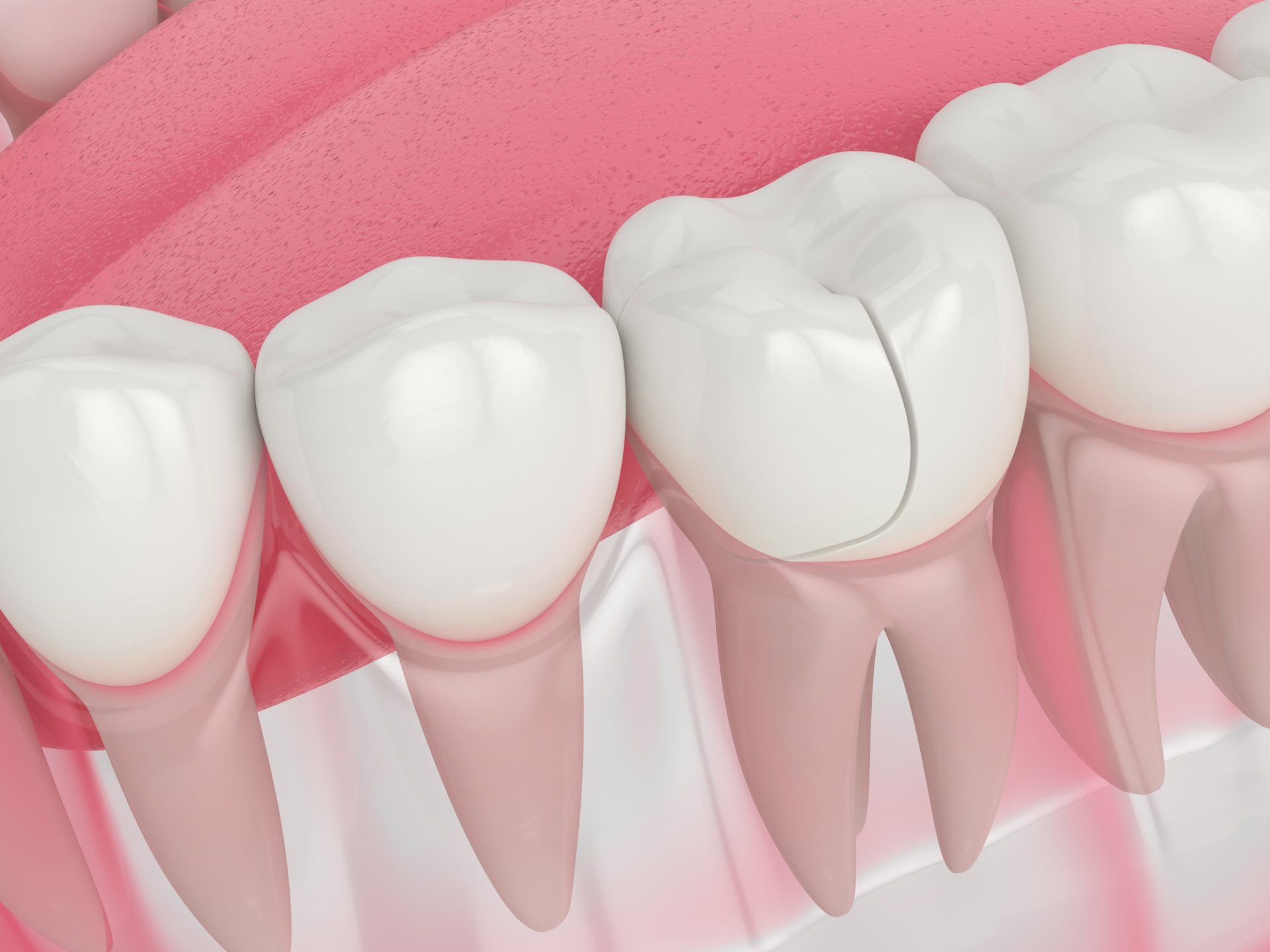 Do You Have Periodontitis? What Are The Symptoms? | Emergency Dentist