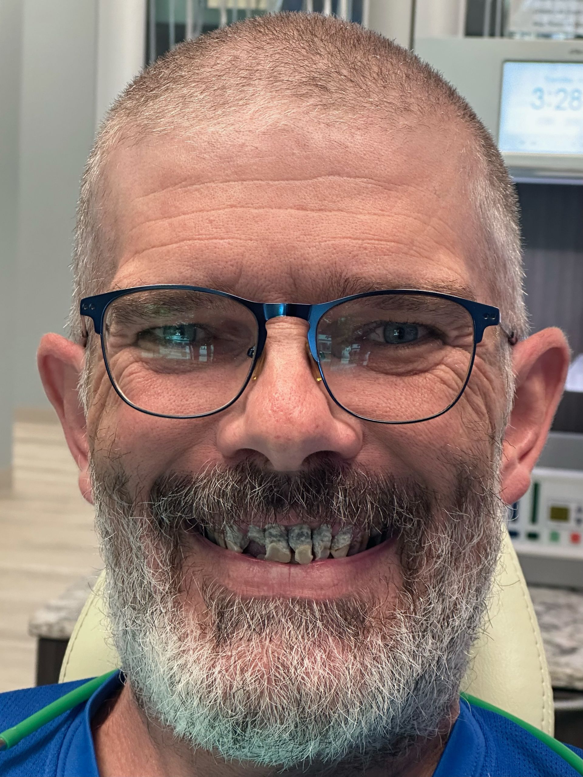 Dental Implants | Infinity Dental Implant Centers | Nationwide