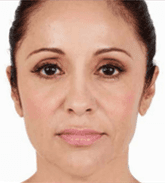 Absolute Dermatology & Medi-Spa | Skin Care | Cedar Park, TX