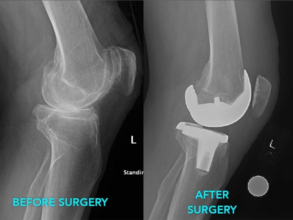Knee Arthroplasty Surgeon Researcher