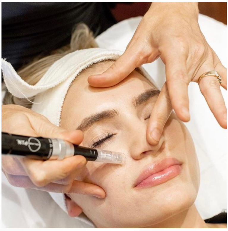 Xeomin | Rockwall, Tx | Derm Revival