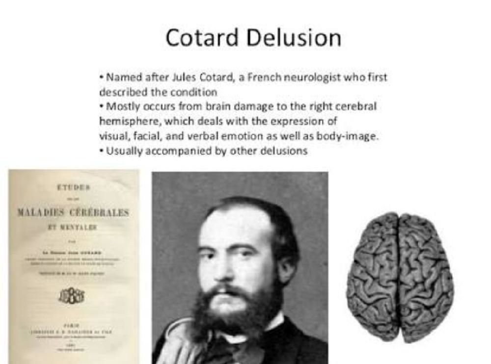 Sindrome di Cotard (delirio di negazione)