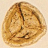Sheffield Area Geology Trust - Lepidodendron Morphology