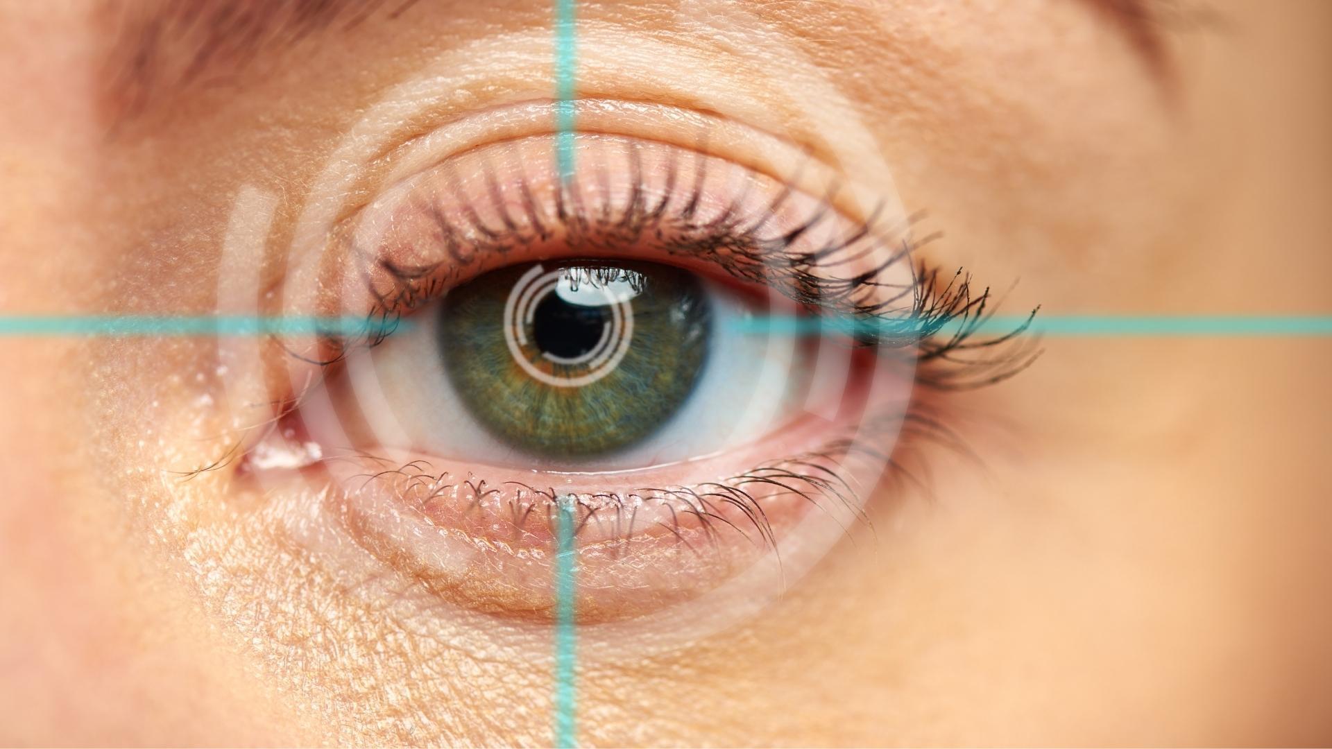 Neuro-Optometry at Oculi Vision