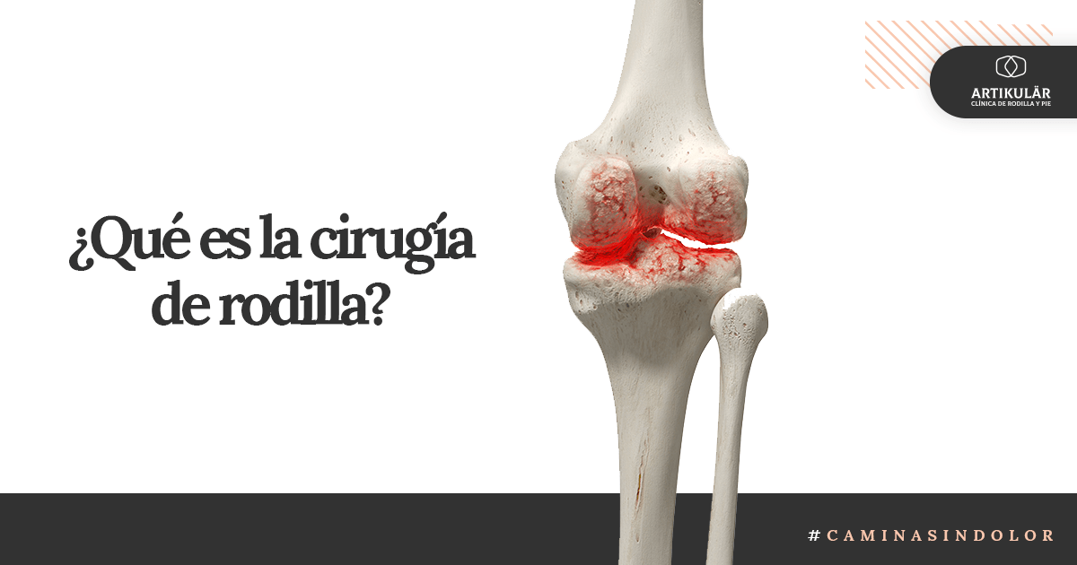 Cartílago de rodilla desgastado: 5 consejos para reducir el dolor