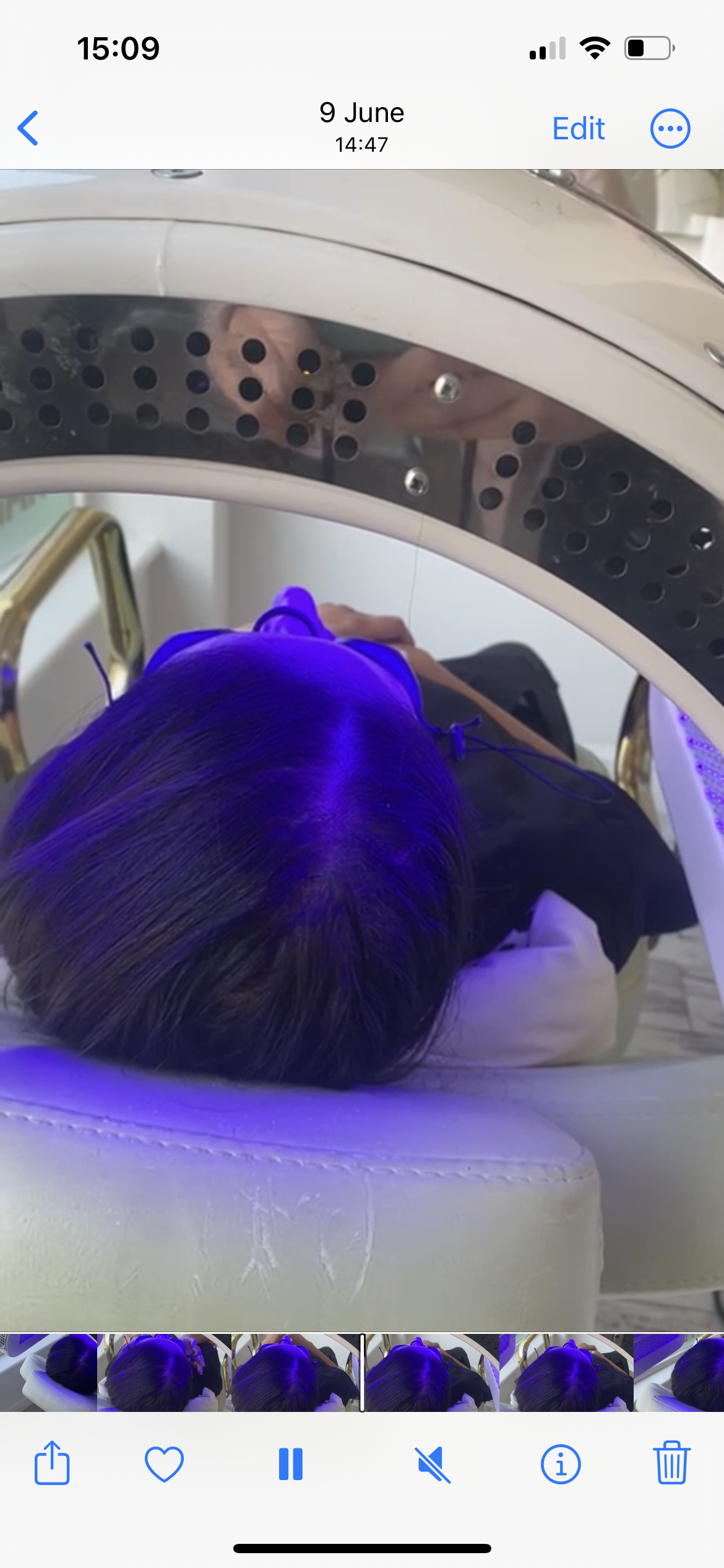 Harnessing the Power of LED Phototherapy for Acne