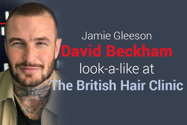 David Beckham Double | FUE Hair Transplant Treatment