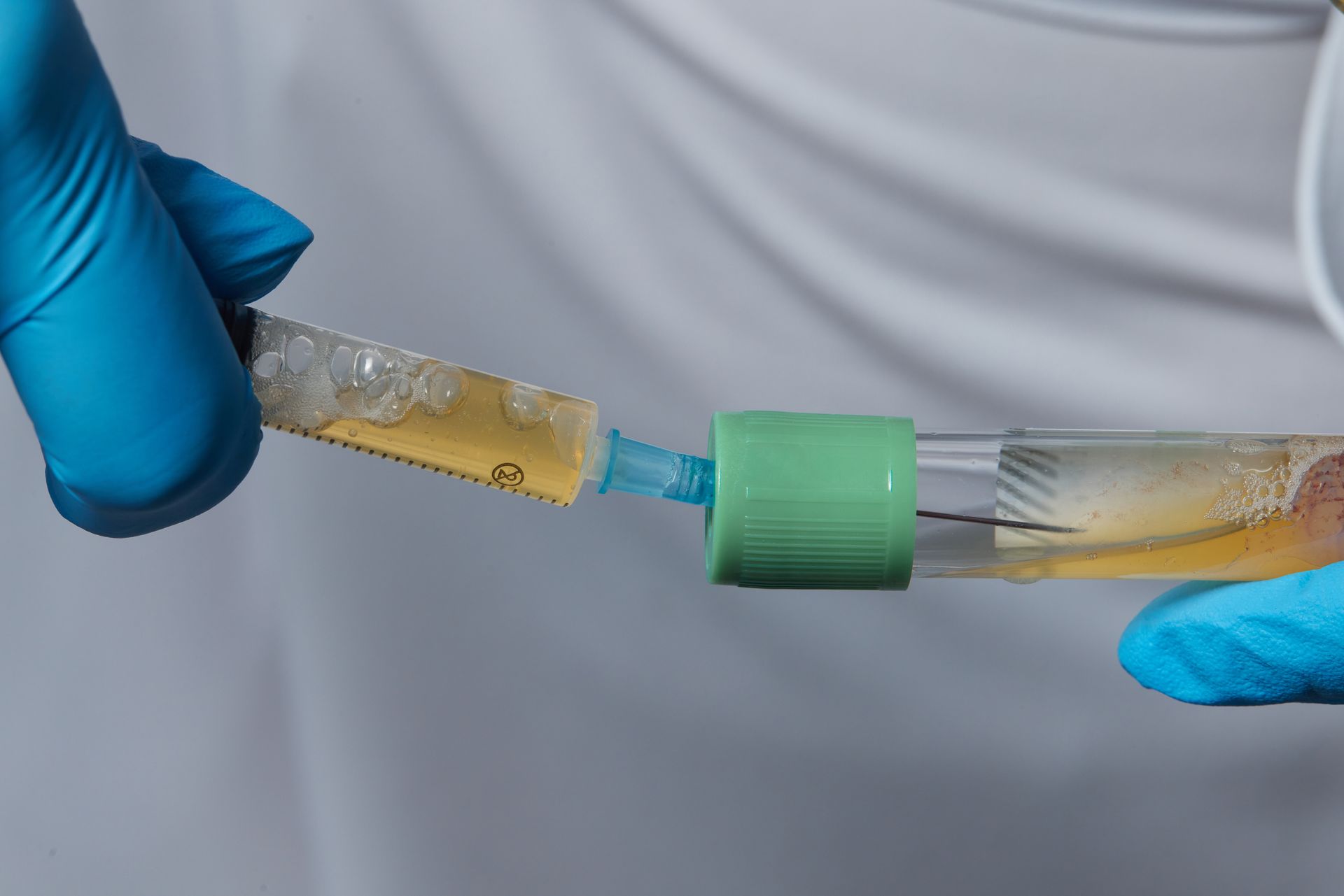 Your Guide to PRF Injections- Myrtle Beach- Sculpt Skin Solutions