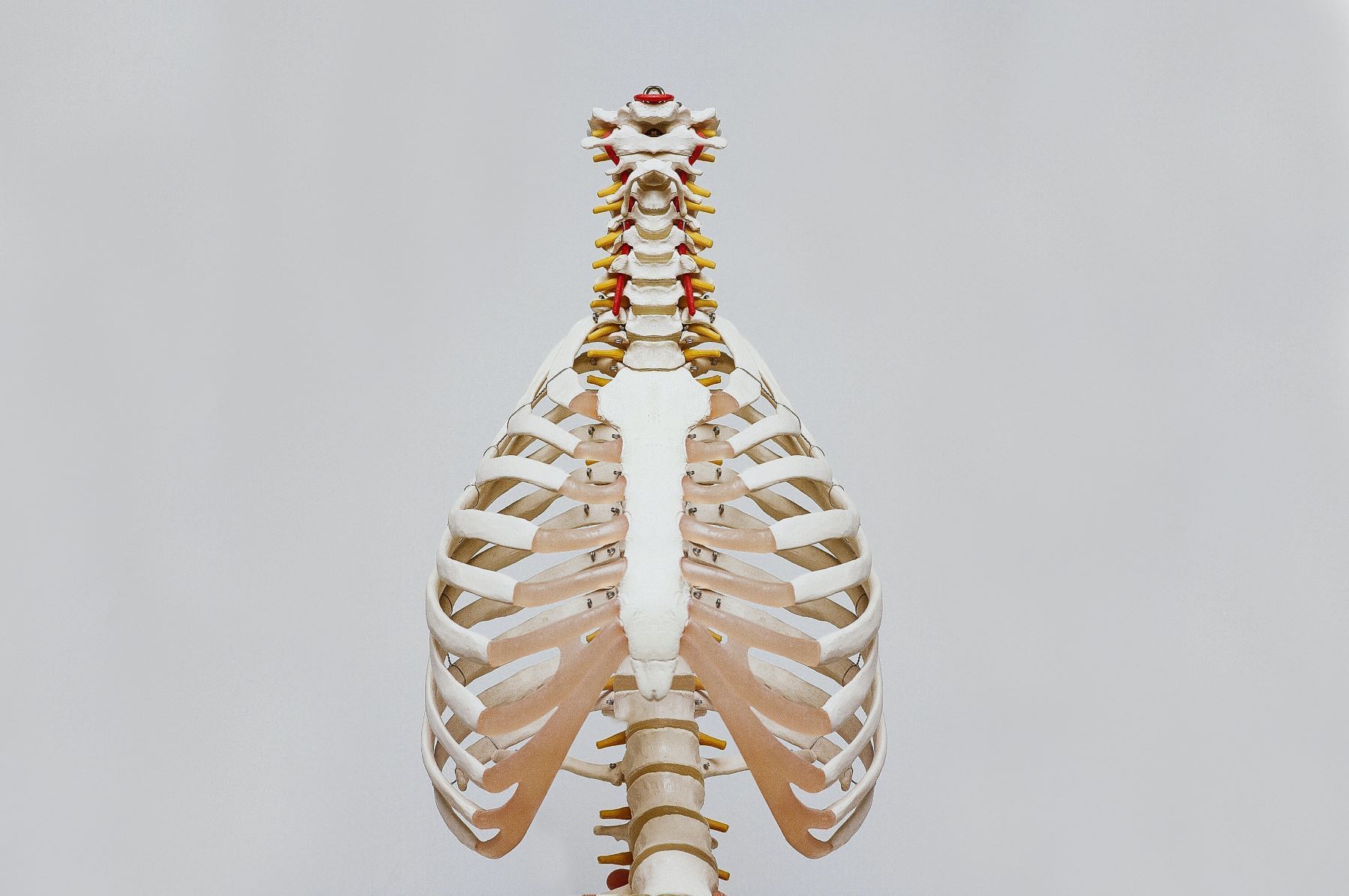What is a Cervical Rib?