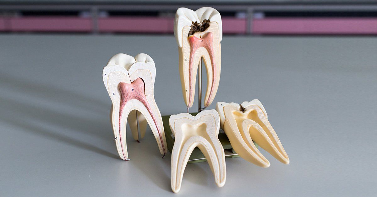The Possible Signs and Symptoms of a Root Canal