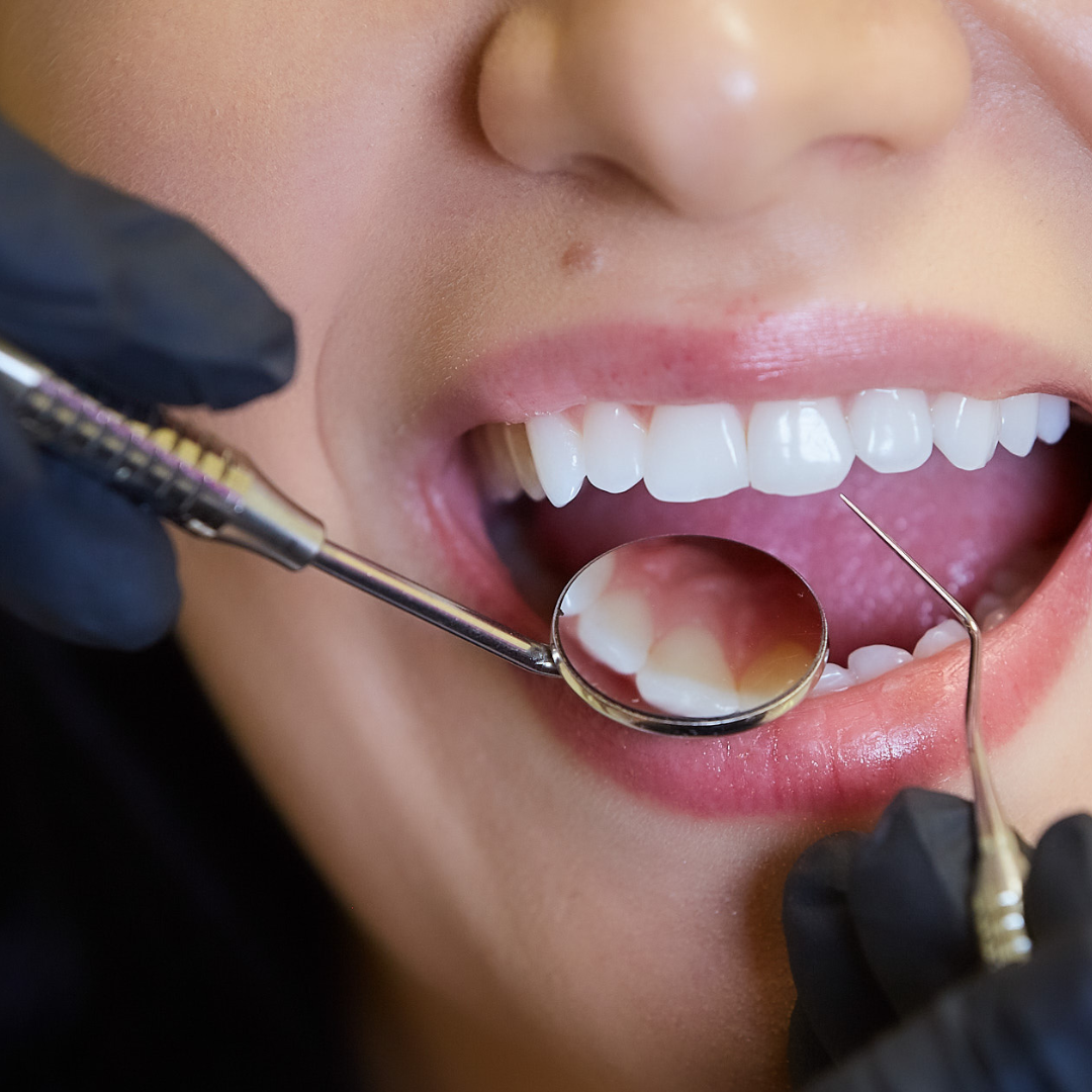 Why are regular dental check-ups important?