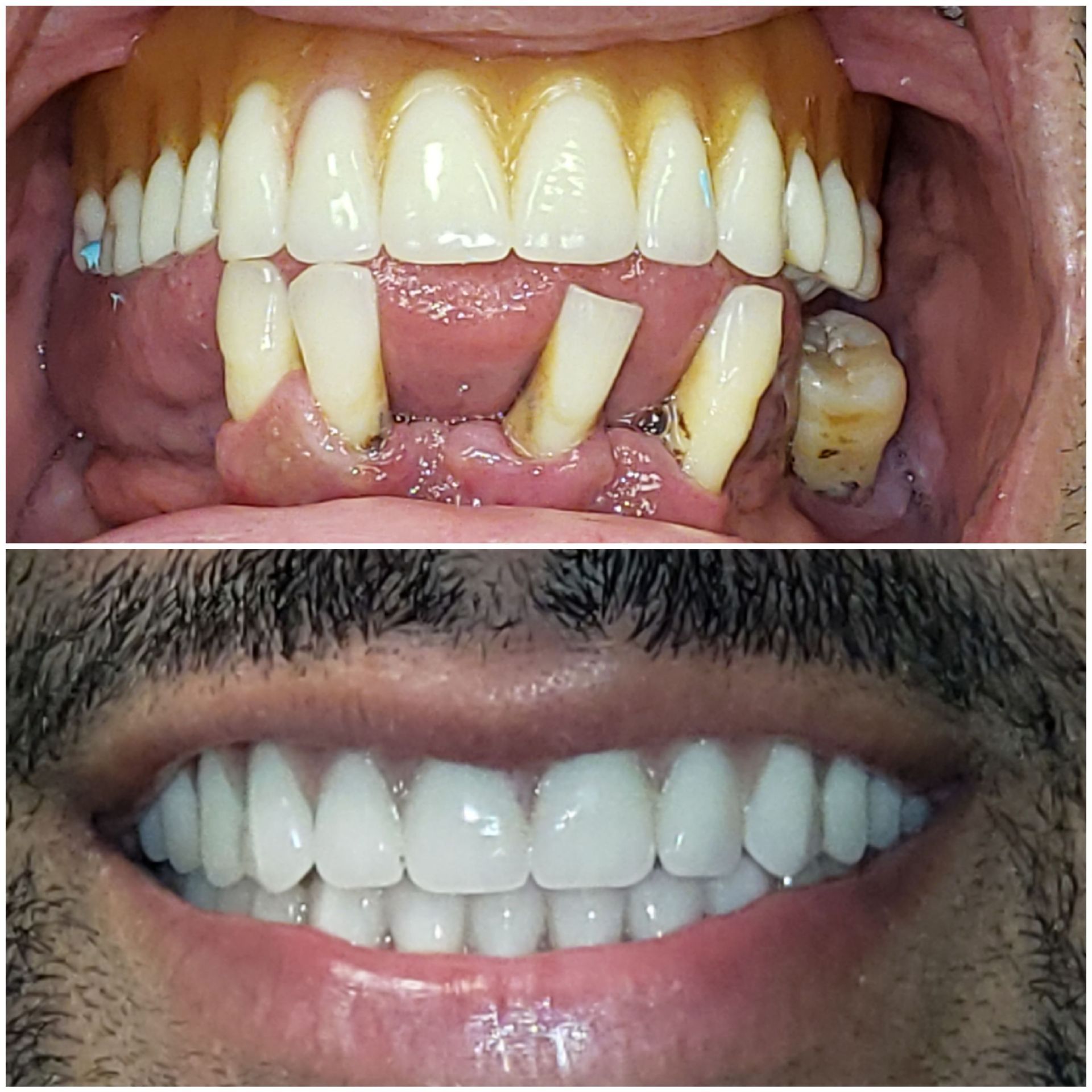 Beach Periodontal, Dental Implants & Med Spa Rochester NY 14626