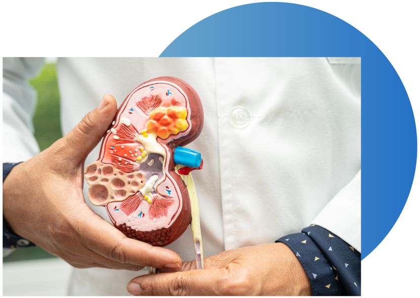 Kidney Conditions | Complete Health