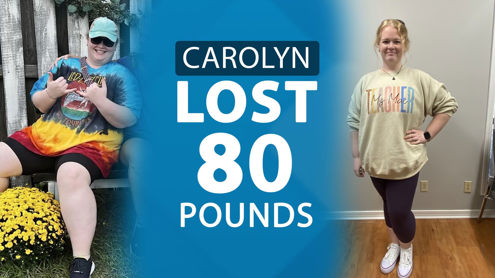 VIDEO: A Bariatric Patient's 80-Pound Weight Loss Journey