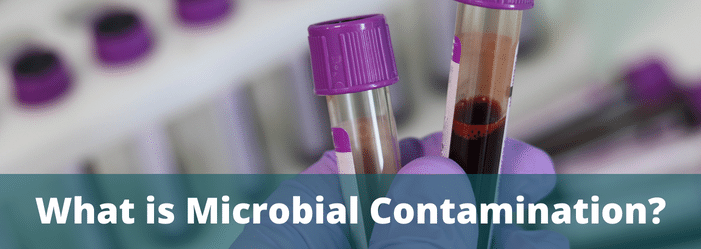 Top Microbial Contamination Testing Methods