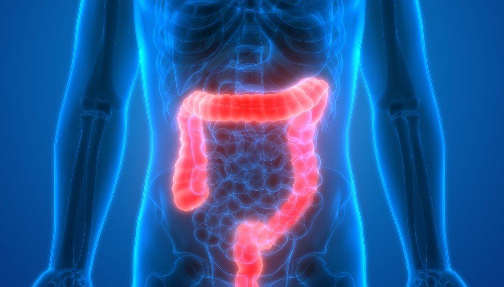 Is Cologuard as Effective as a Colonoscopy?