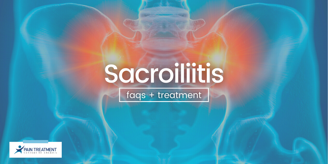Sacroiliitis: FAQs + Treatment Options