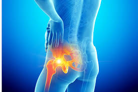 Hip Pain: What Your Symptoms Might Be Telling You