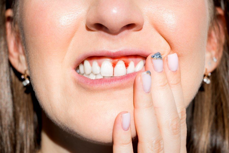 Gum Disease | Hampden Ave Dental | Lakewood, CO