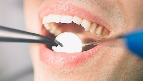 Numb Tongue and Other Worrying Sensations Following Dental Procedures