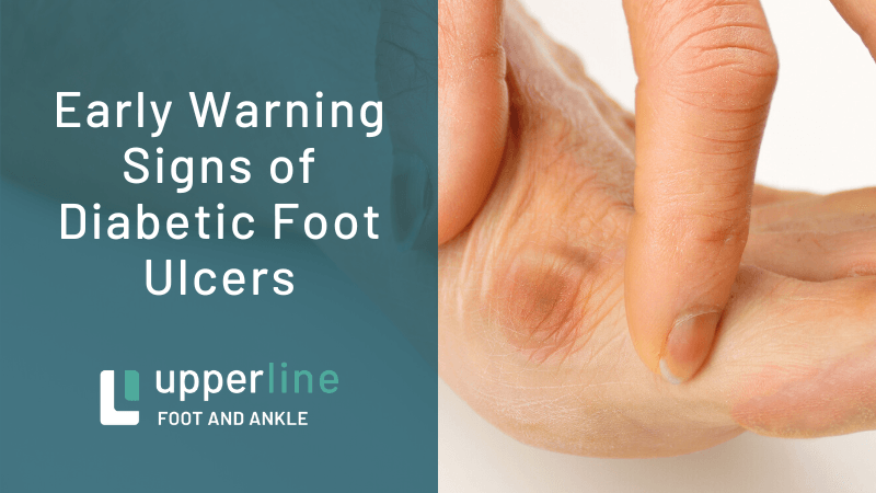 Early Warning Signs of Diabetic Foot Ulcers