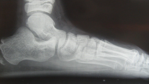 Pier Francesco Costici