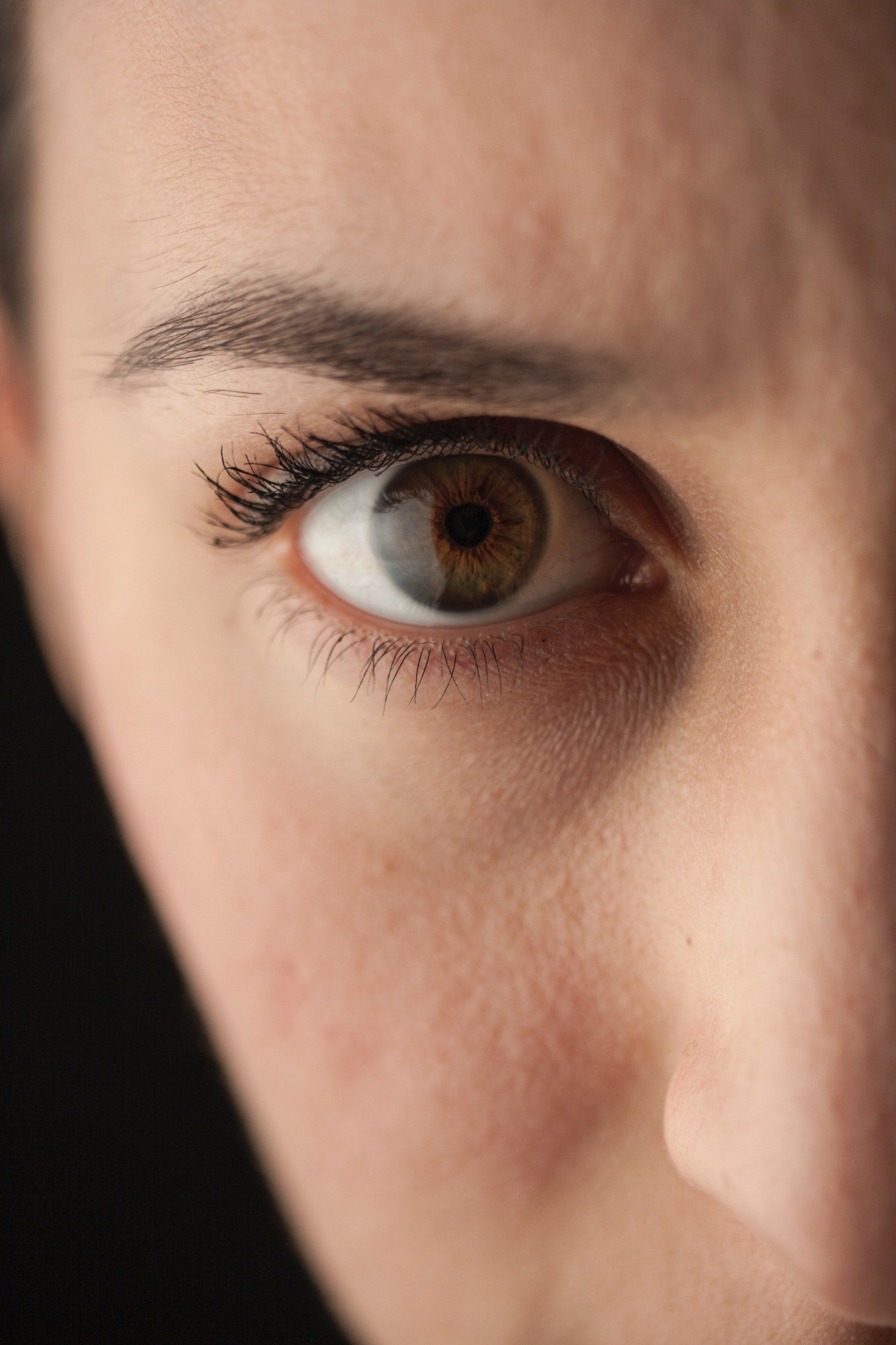 Corneal Cross Linking | Milwaukee Eye Surgeons