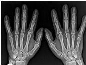 CMX X-Ray and Medical Imaging - Chaban Medical and Cmosaix