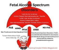 FACTS ABOUT FASD
