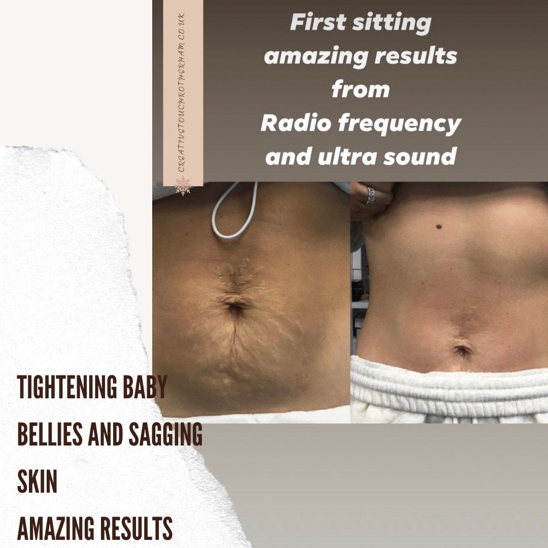 Experienced Beautician at Creative Touch in Rotherham