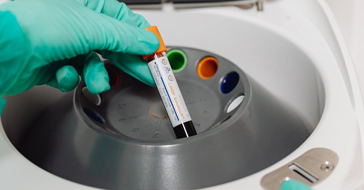 Mobile Phlebotomy | Serving East Valley & Phoenix