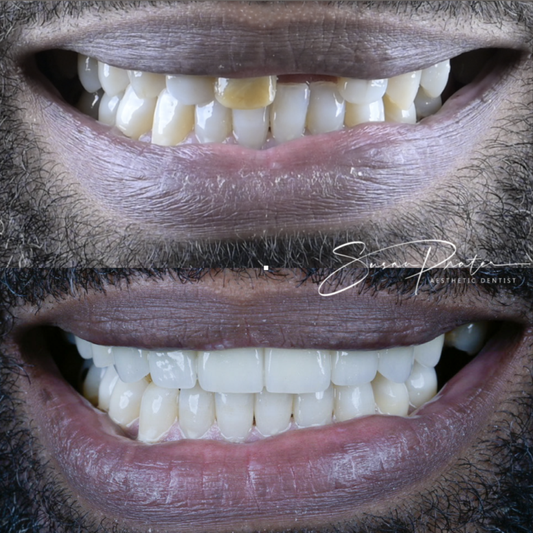 Virtual Smile Consultations | Cre8 Smile Studio