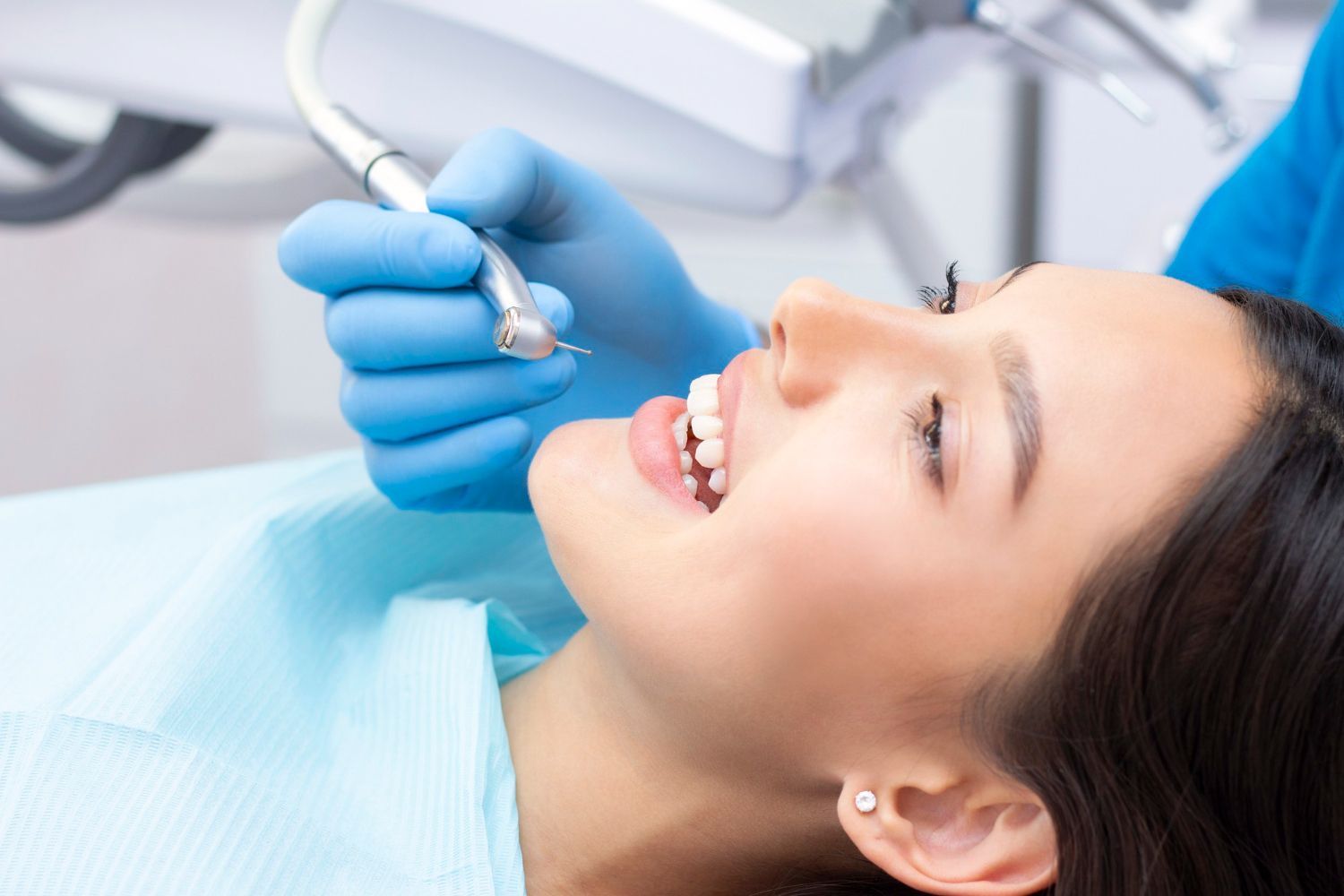 Benefits of Choosing Dental Implants Over Bridges