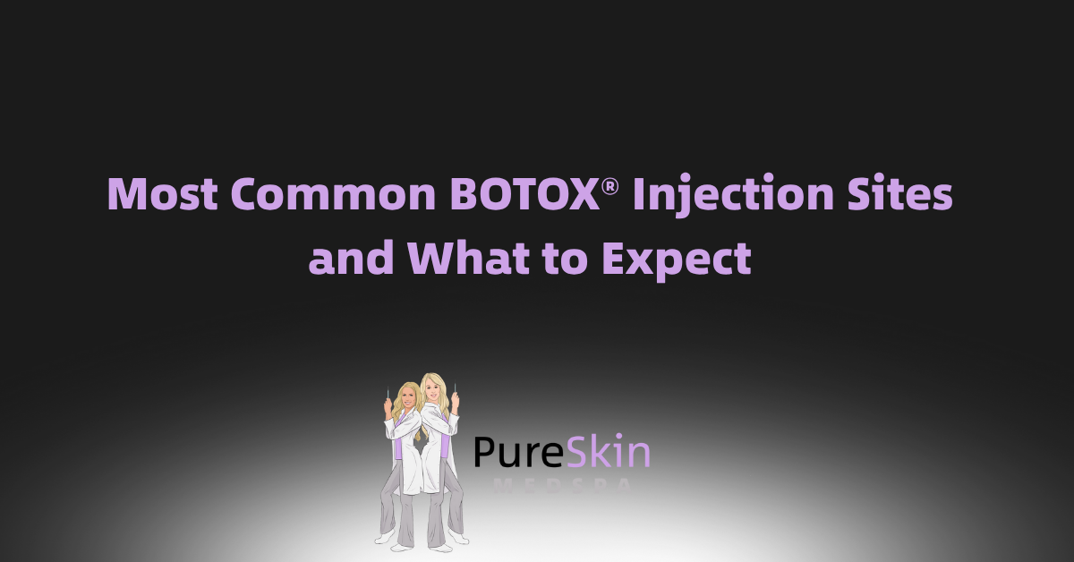 Pure Skin: Most Common BOTOX® Injection Sites and What to Expect