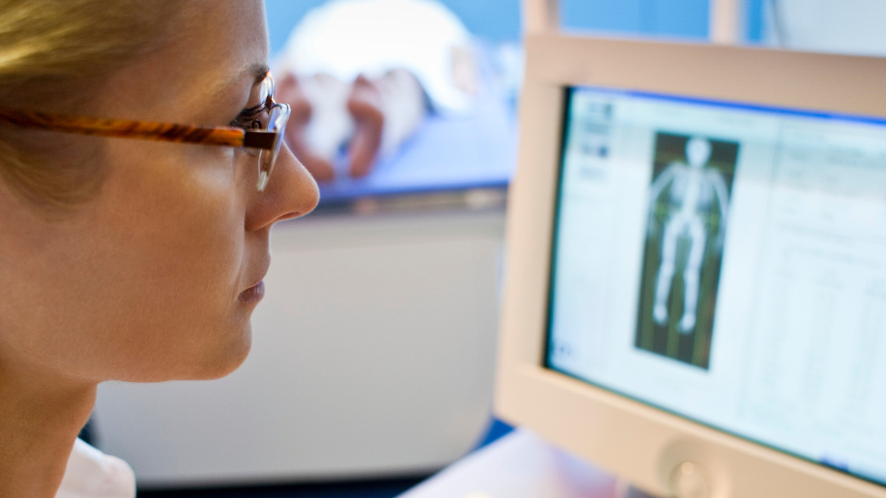 How Does A DEXA Scan Measure Bone Density?