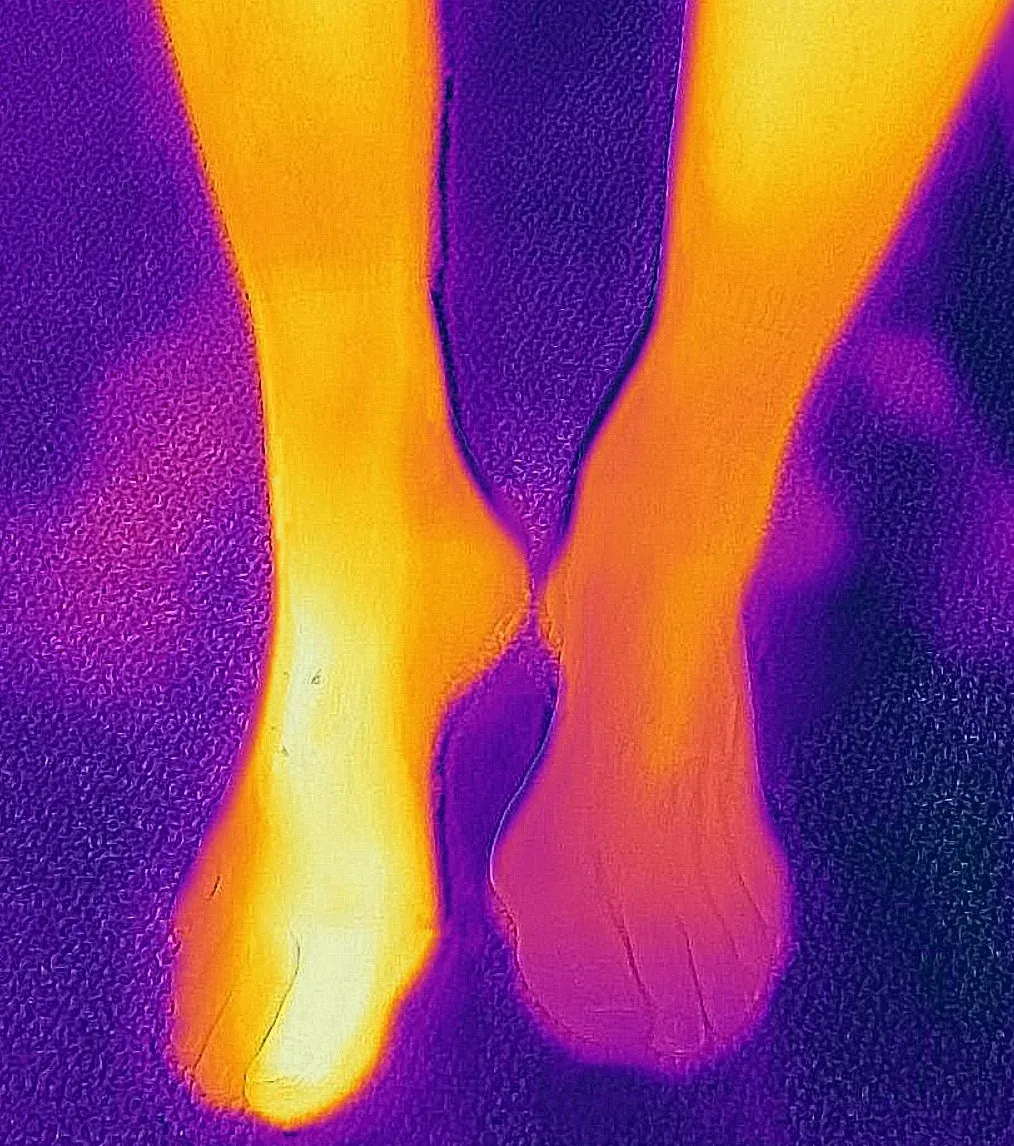 NEUROPATHY TREATEMENT | THERMAL IMAGING | PEORIA IL