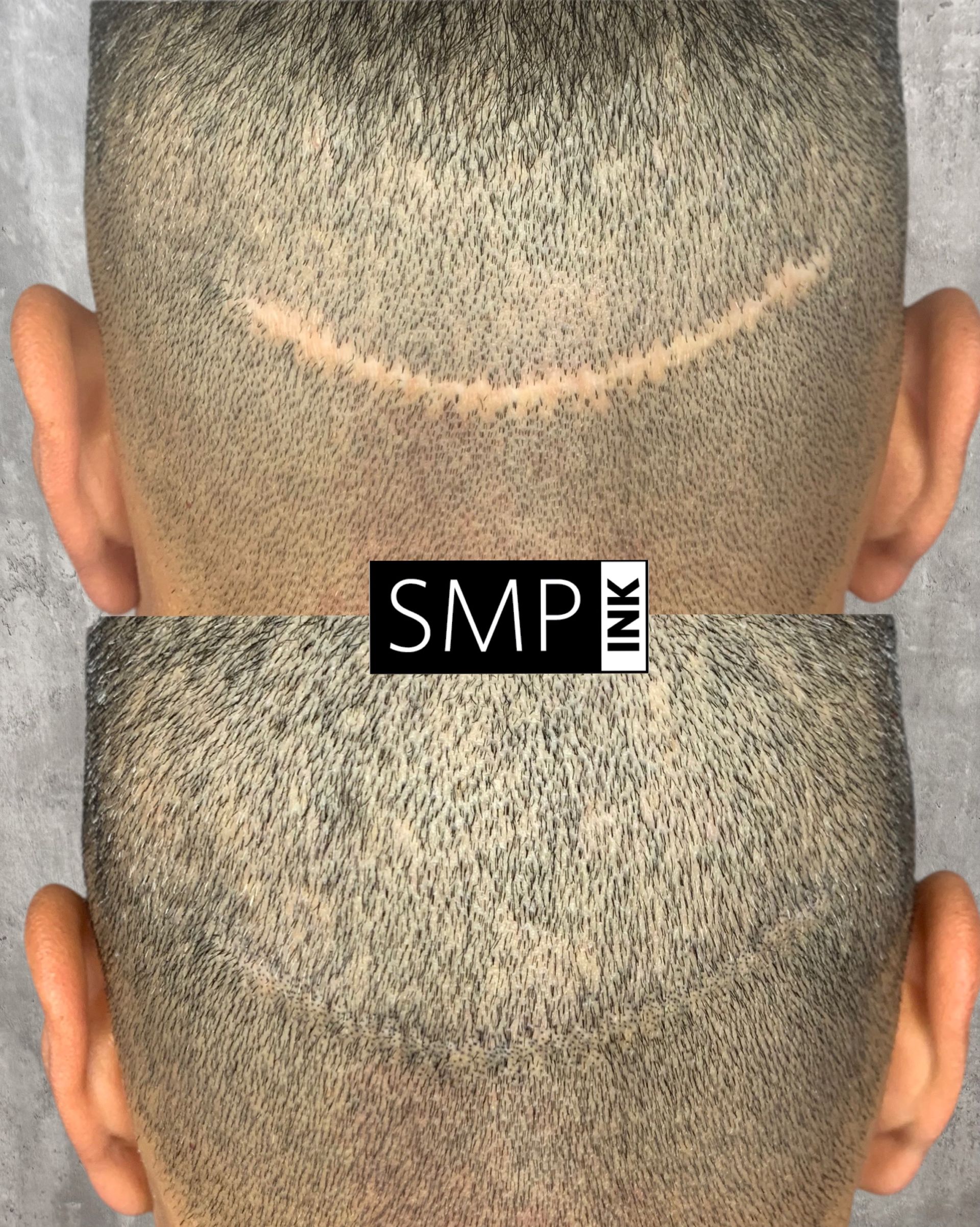 SMP Scar Camouflage | SMP INK | Las Vegas, Nevada