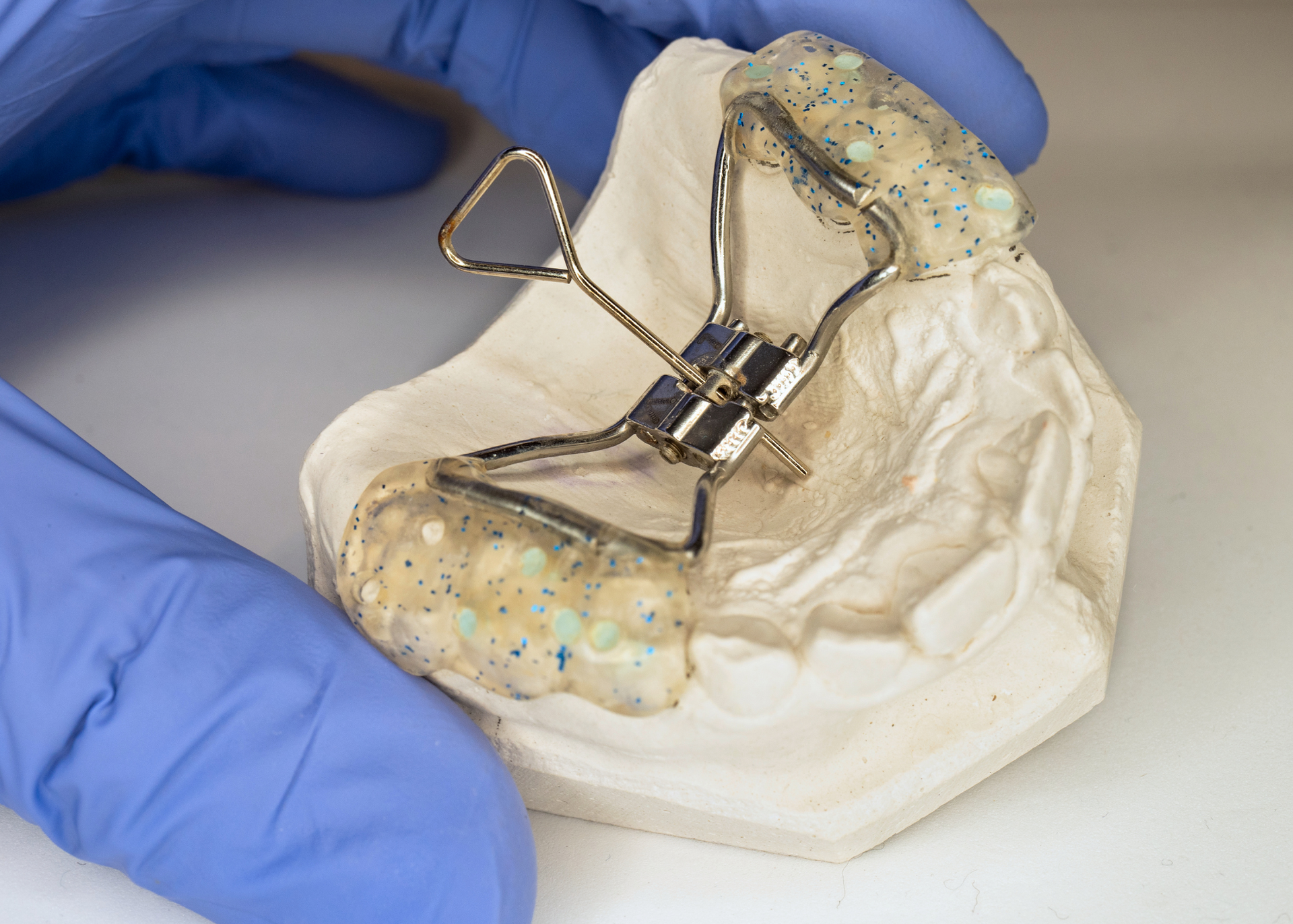 Palatal Expanders for Growing Smiles in Florida