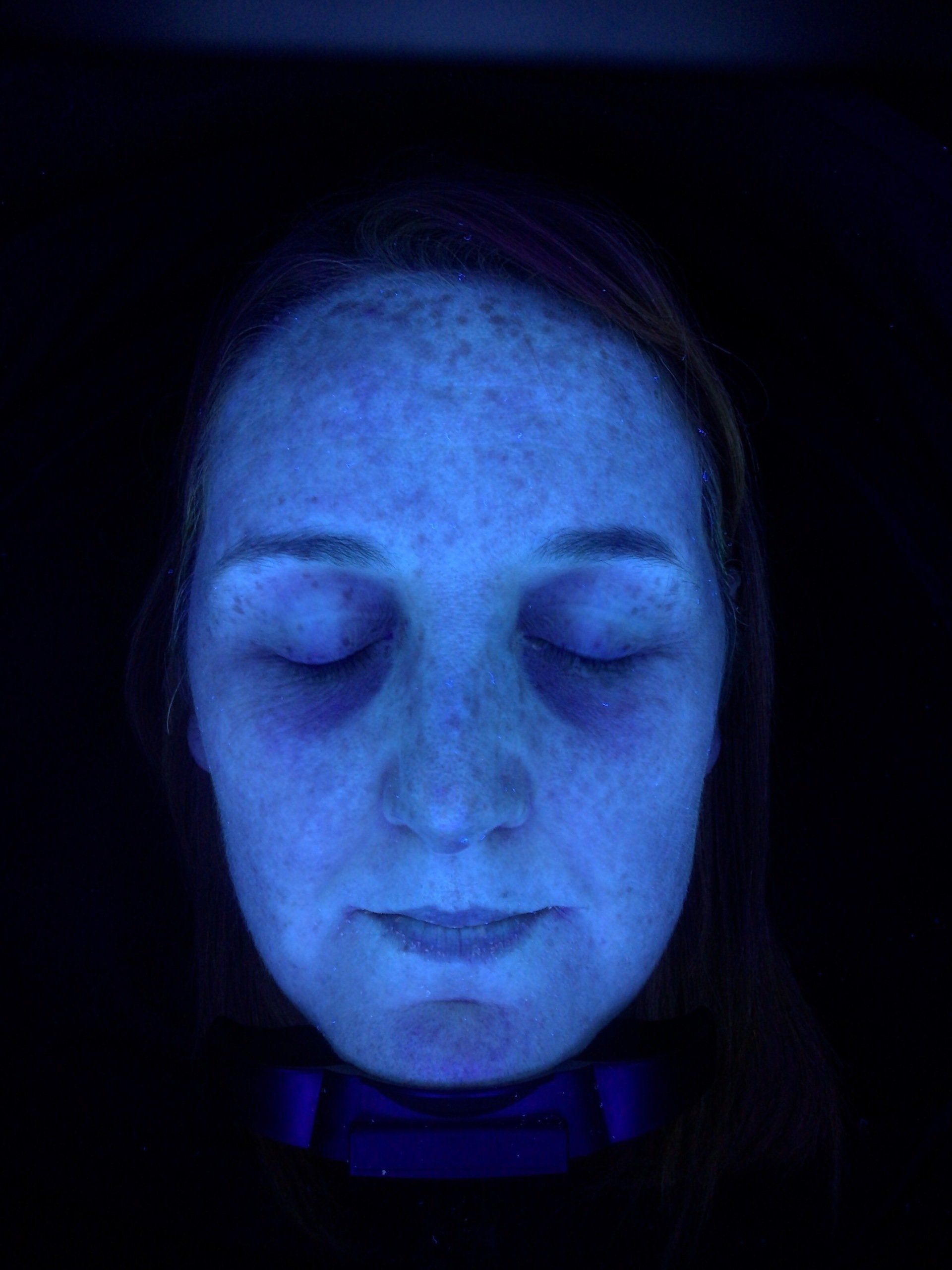 Skin consultation and analysis | Skin care consultation Crosby | The ...