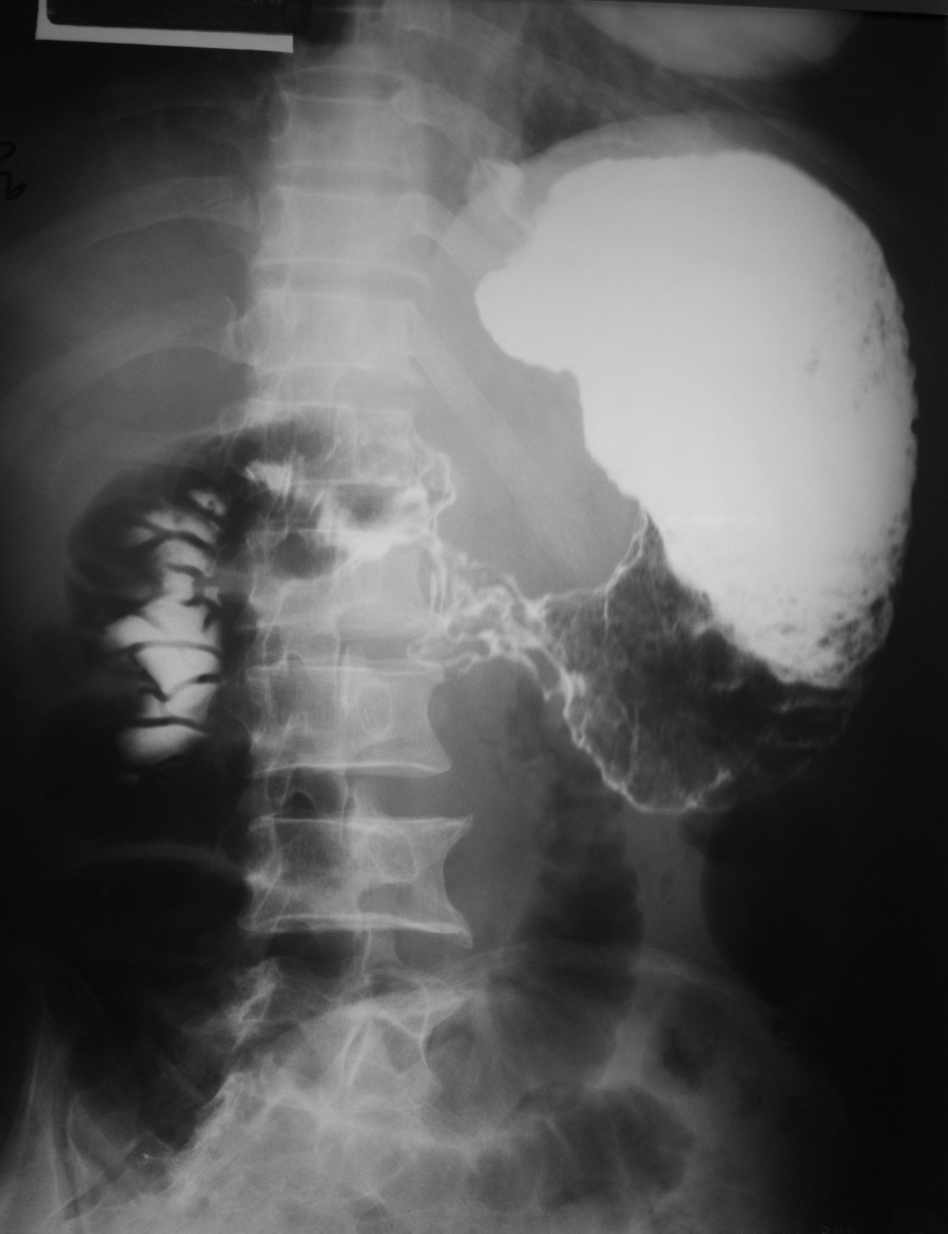 Conditions We Treat at MidMichigan Gastroenterology Associates | Flint