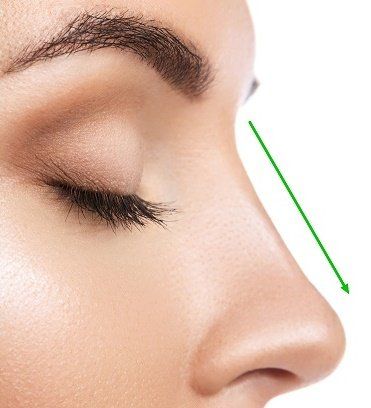 The Ultimate Guide to Non-Surgical Rhinoplasty