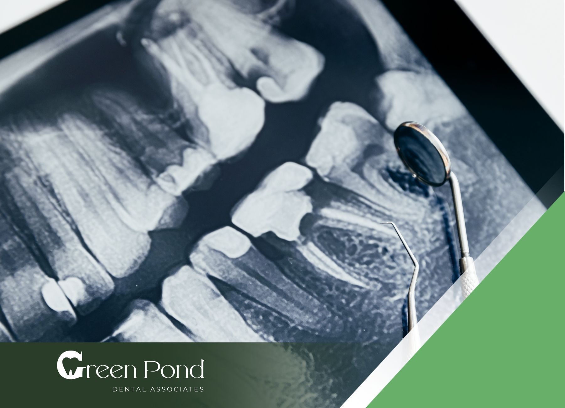Can Dentists Really Fix the Worst Teeth? | Green Pond Dental