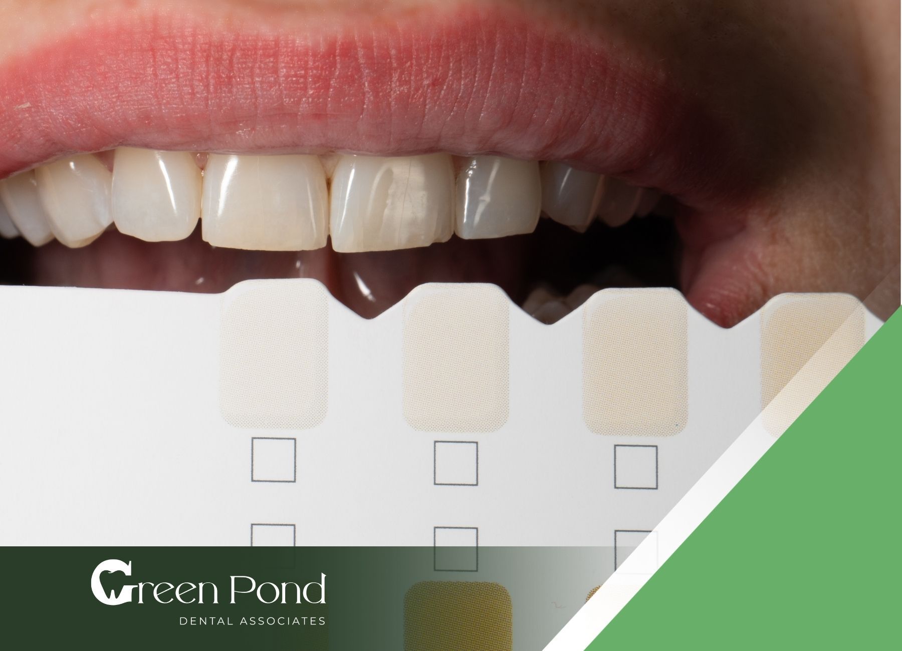 Black Stains on Teeth? Here’s What You Can Do to Remove Them