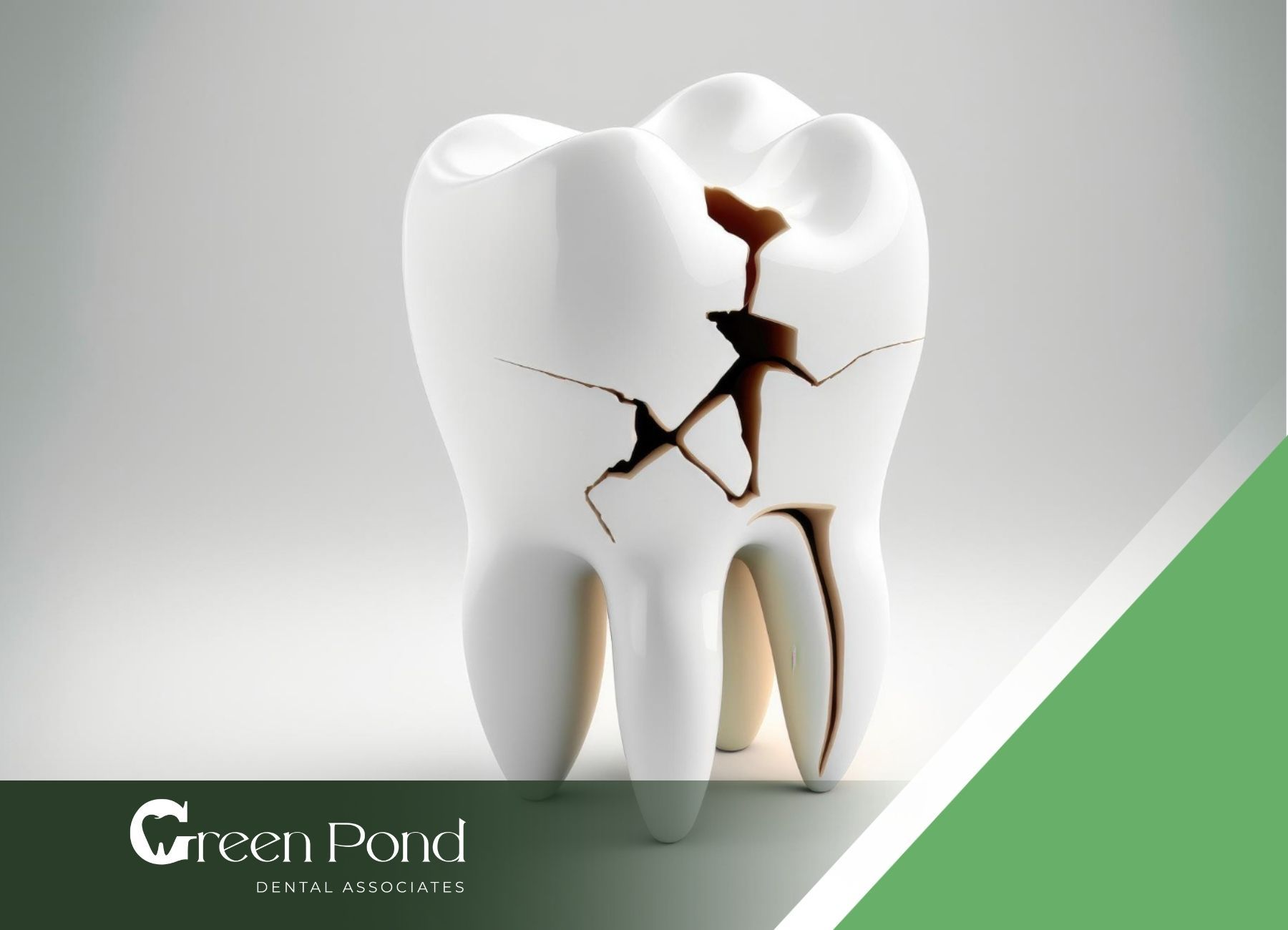 What Happens If You Leave a Broken Tooth Untreated?