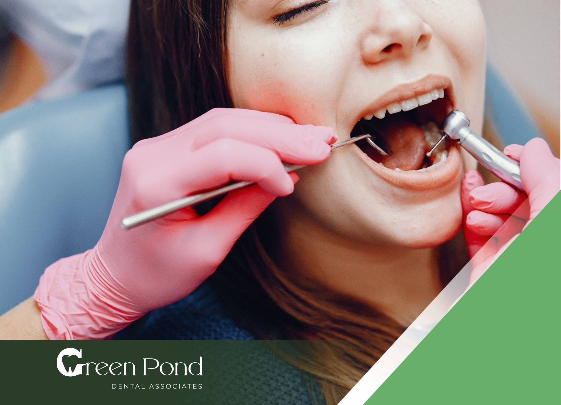 Step-by-Step Process for Removing Temporary Dental Fillings