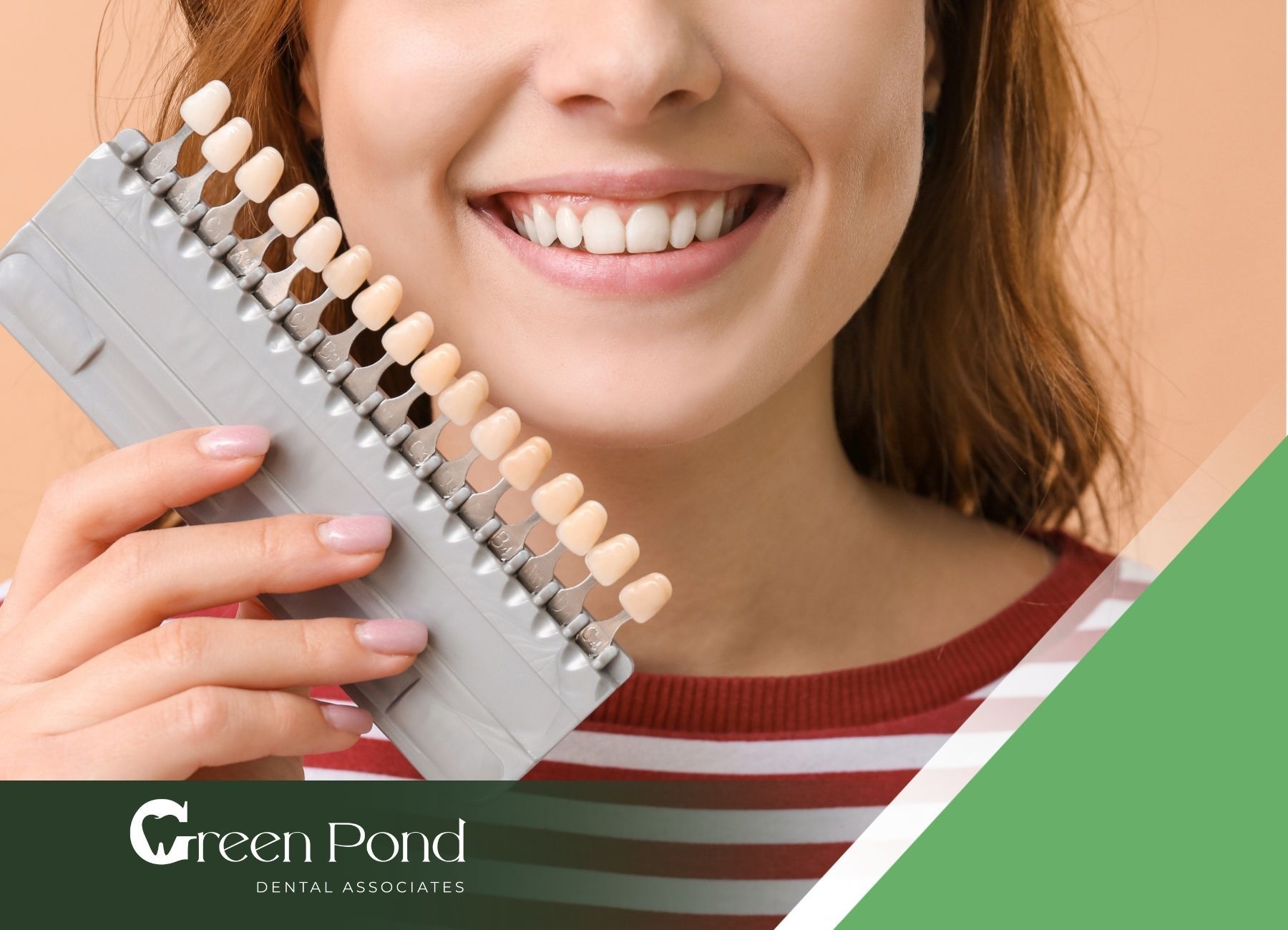 Understanding Veneers After a Decade | Green Pond Dental