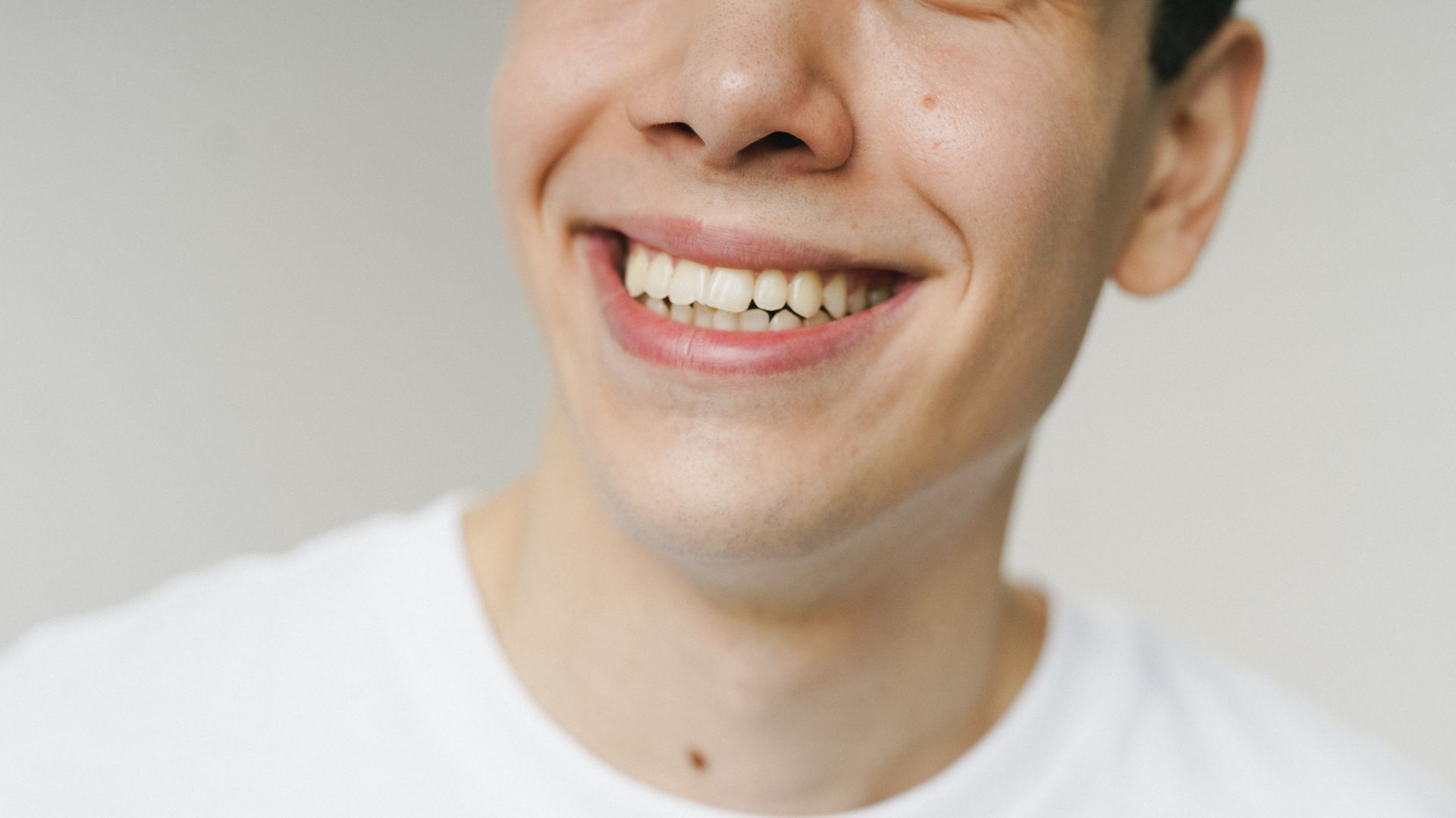 How to Fix Gummy Smile? Treatment Options | Green Pond Dental