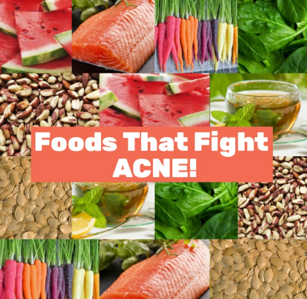 Foods that Fight Acne!